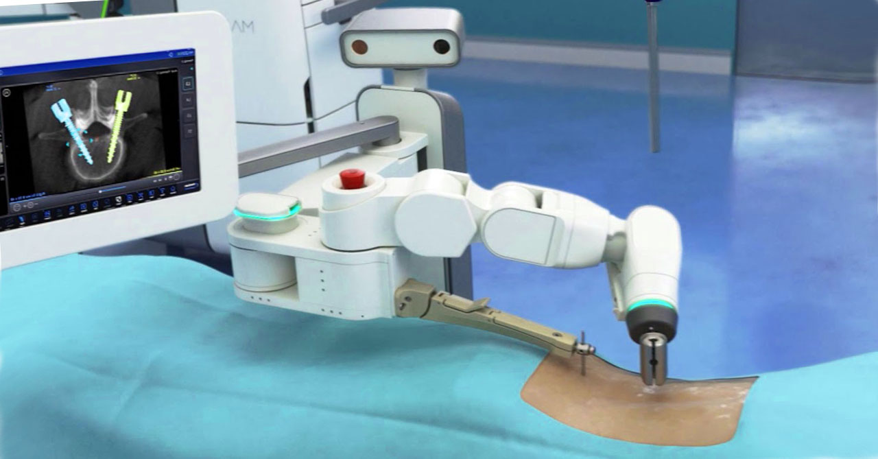 St. Mary's Healthcare Acquires Mazor Robotics' Renaissance System